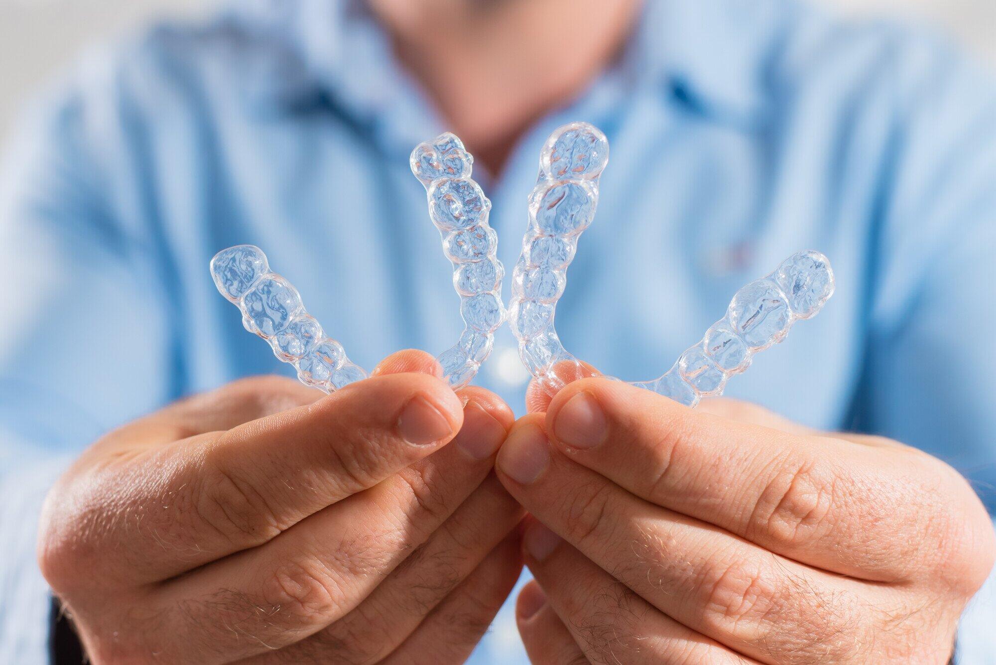 Top Benefits of Choosing Invisalign Clear Aligners - Management Works ...